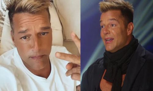 La culpa del cambio en el rostro de Ricky Martin la tiene un suero ...